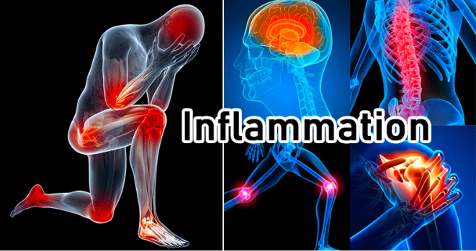 Playing with Fire: How Modern Lifestyle Fuels Inflammation | The Health ...